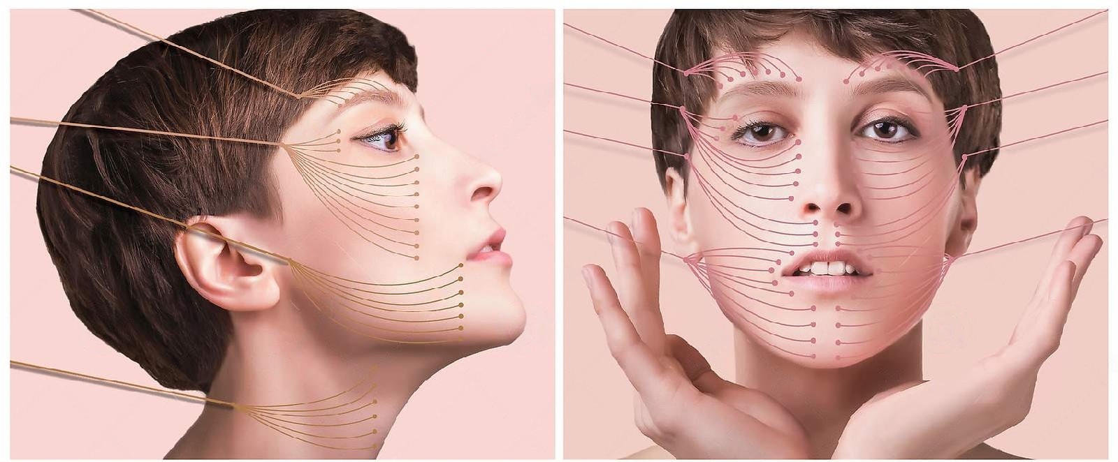 Thread Lift - Twacha Aesthetic Clinic in Nagpur, Maharashtra, India